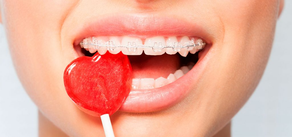 Bonitas por fuera, ¿sanas por dentro? - Clínica Dental Vilaboa